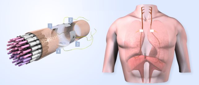 phrenic nerve function